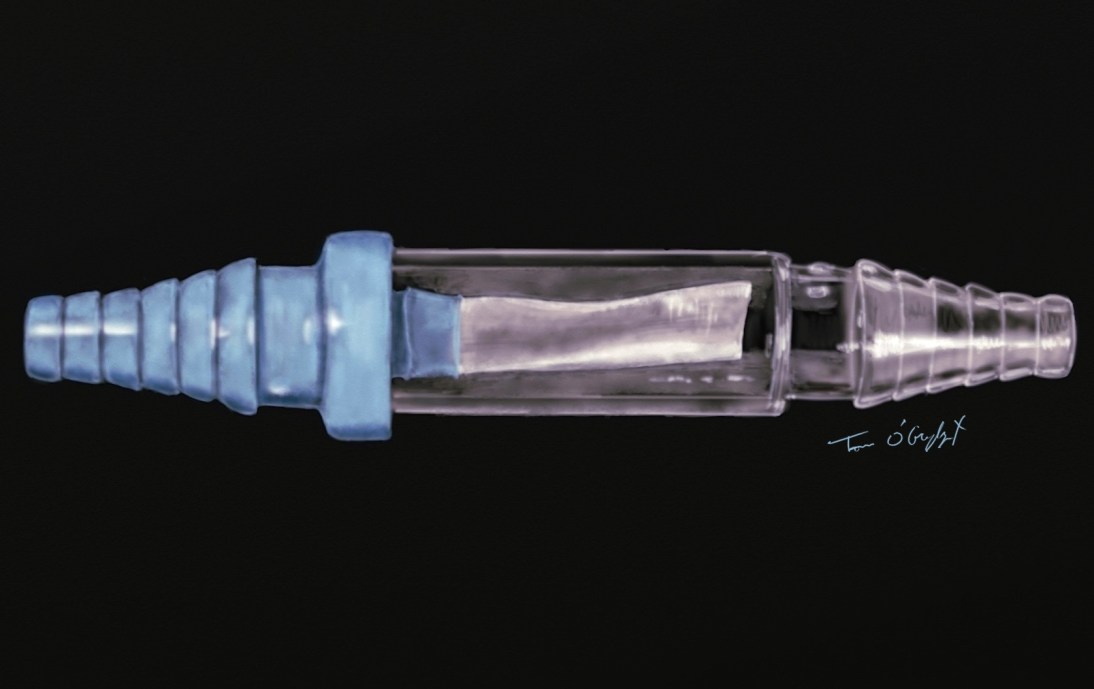 Drainage pleural ou thoracique, thoracostomie | thoracotomie