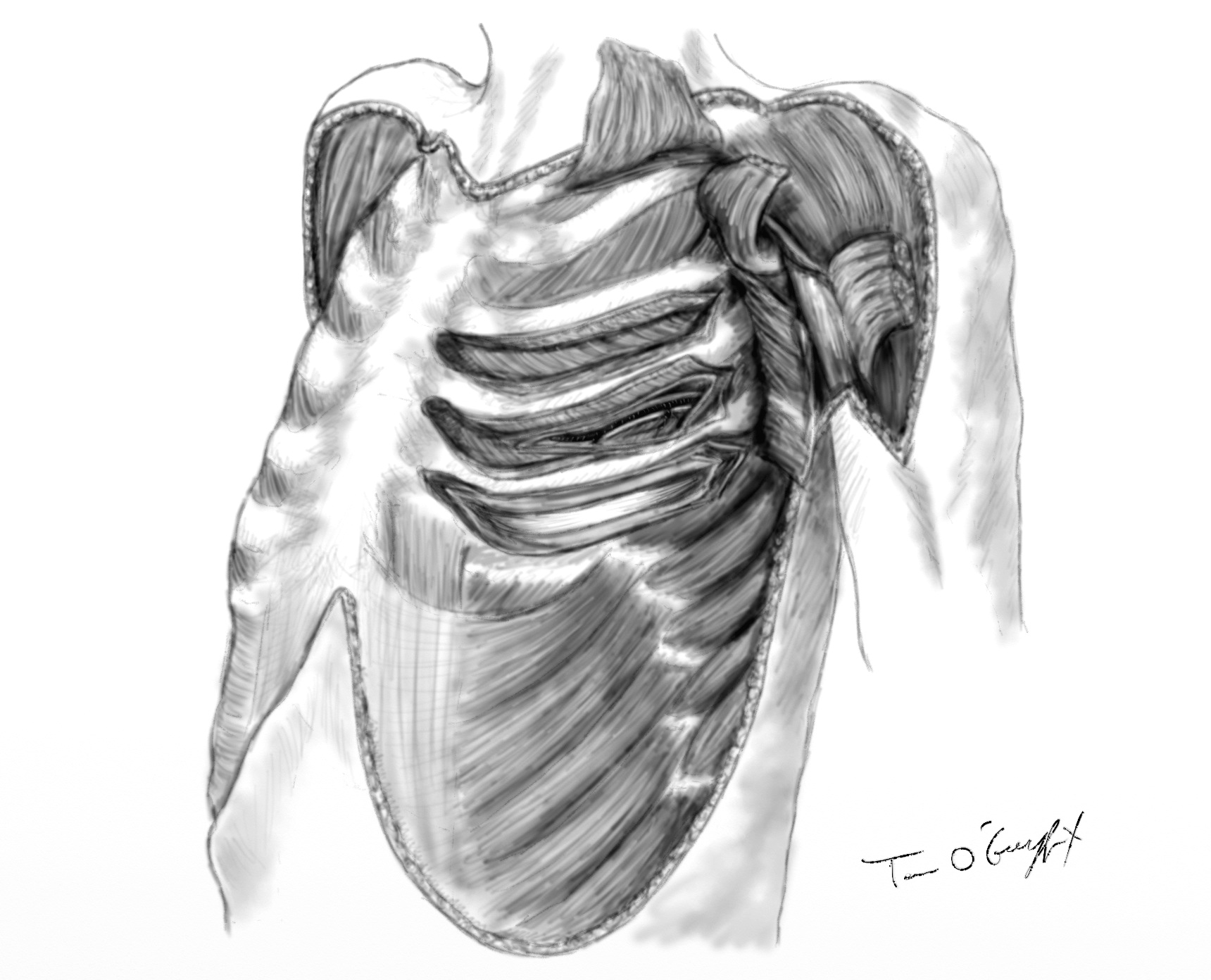 thorax dissection Rouviere | thoracotomie